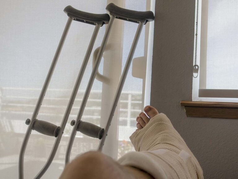 Baton Rouge Car Accident Amputation Lawyer - Rozas Injury Law